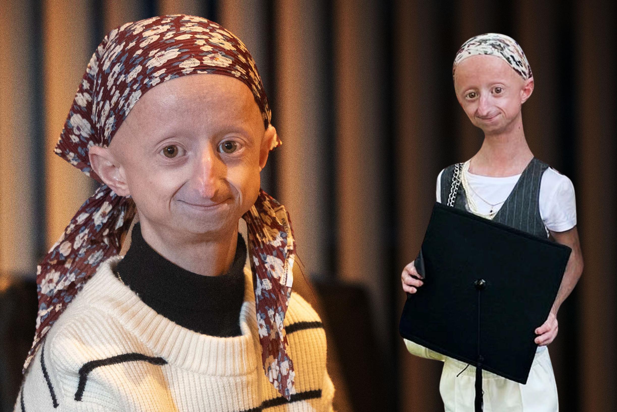 Diepenbeekse progeriapatiënte Amber (18) studeert af | GVA