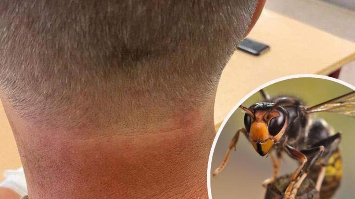 Tuinaanlegger raakt nest van Aziatische hoornaars en krijgt twintig ...