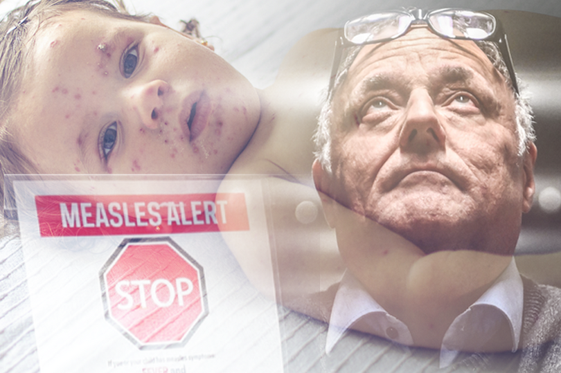 De mazelen: een erg besmettelijk eeuwenoud virus dat nooit verdwijnt en ...