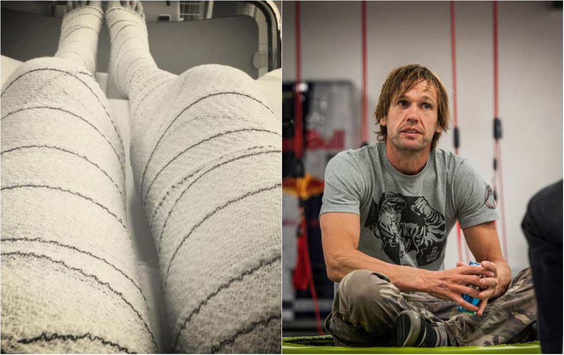 Marc Herremans bracht maand door in ziekenhuis met zware brandwonden ...